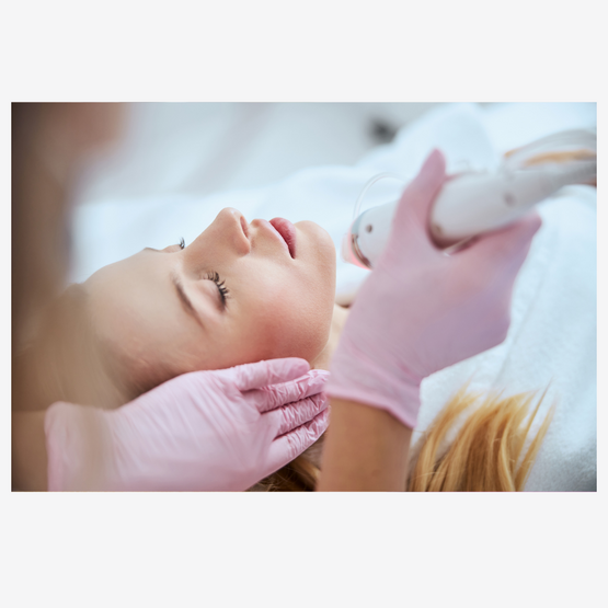 RF Microneedling vs Microneedling: Why RF Get Better Results